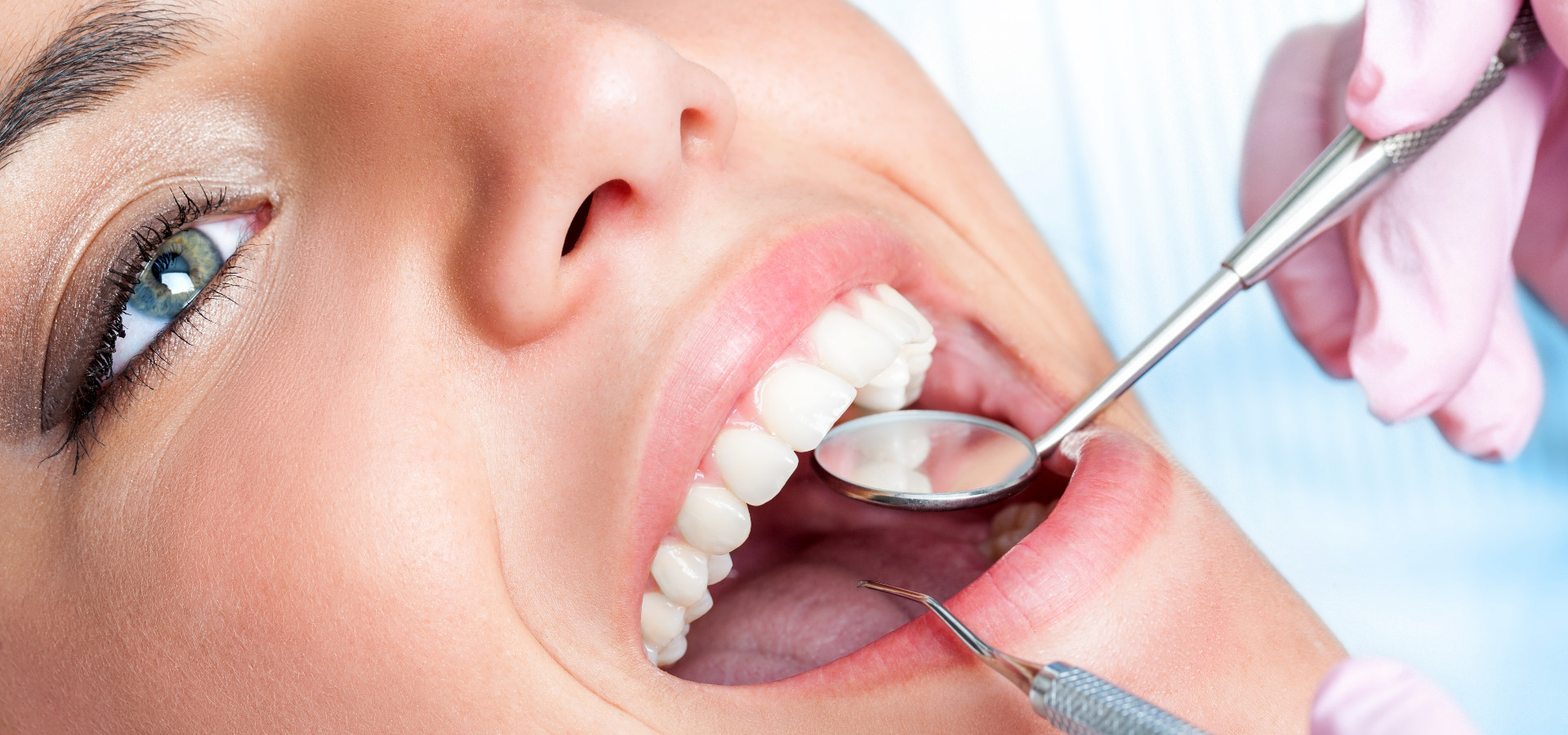 Zahnbleaching - Methoden und Produkte zur Zahnaufhellung